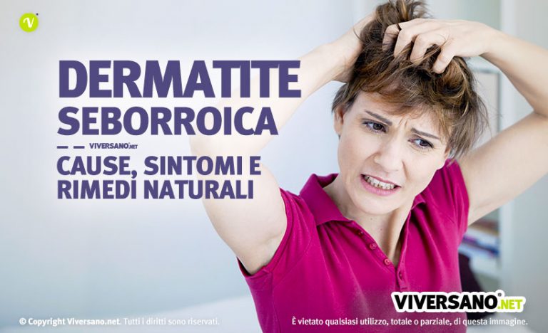 Dermatite seborroica: sintomi, cause, rimedi naturali e consigli alimentari