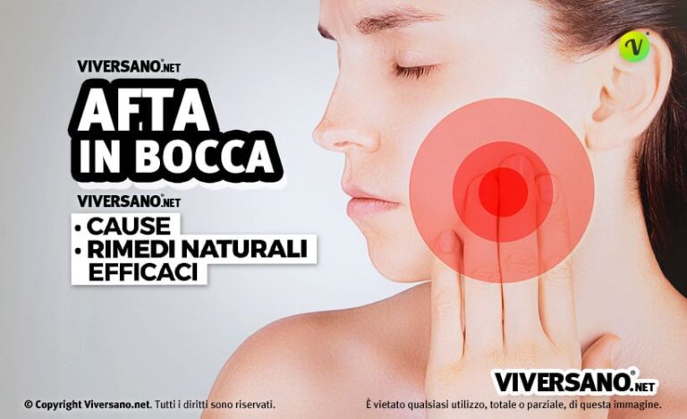 Afte in bocca: cause e rimedi naturali efficaci per curarle