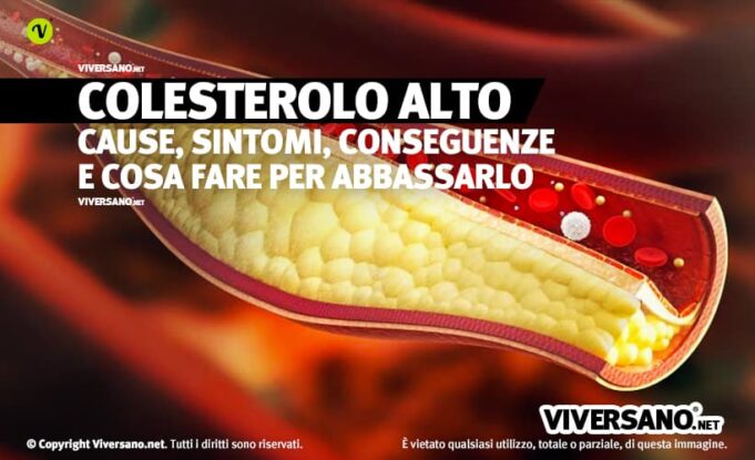 Colesterolo: cos'è, valori, differenze tra hdl o ldl e cosa fare se alto