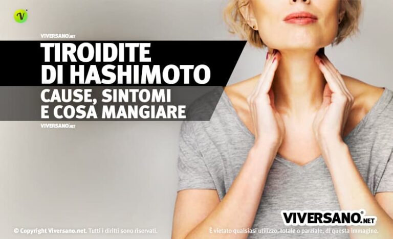 Tiroidite di Hashimoto: cause, sintomi e dieta per la tiroide autoimmune